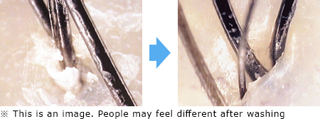 HAIRREPRO Men's Scalp Care Collection | Aderans Singapore Official Site