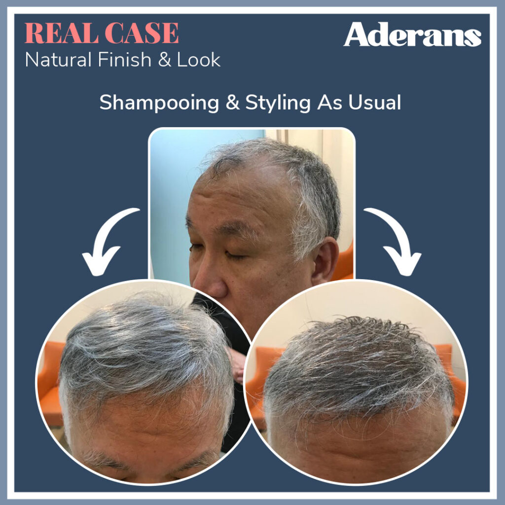 Men top | Aderans Singapore Official Site
